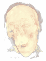 Graphics Runner: Volume Rendering 102: Transfer Functions